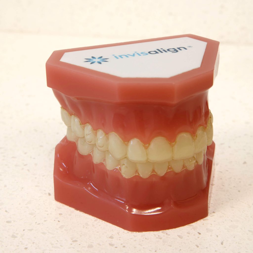 Invisalign in Washington, DC | Georgetown Orthodontics